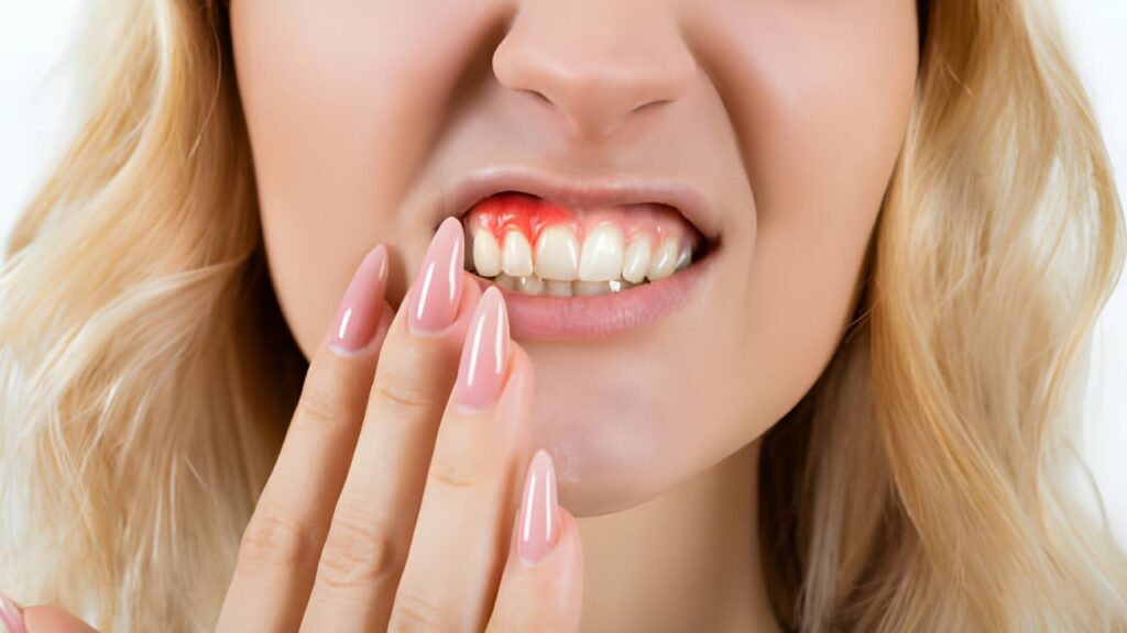 Gengiva: saiba as principais informações sobre esse tecido!